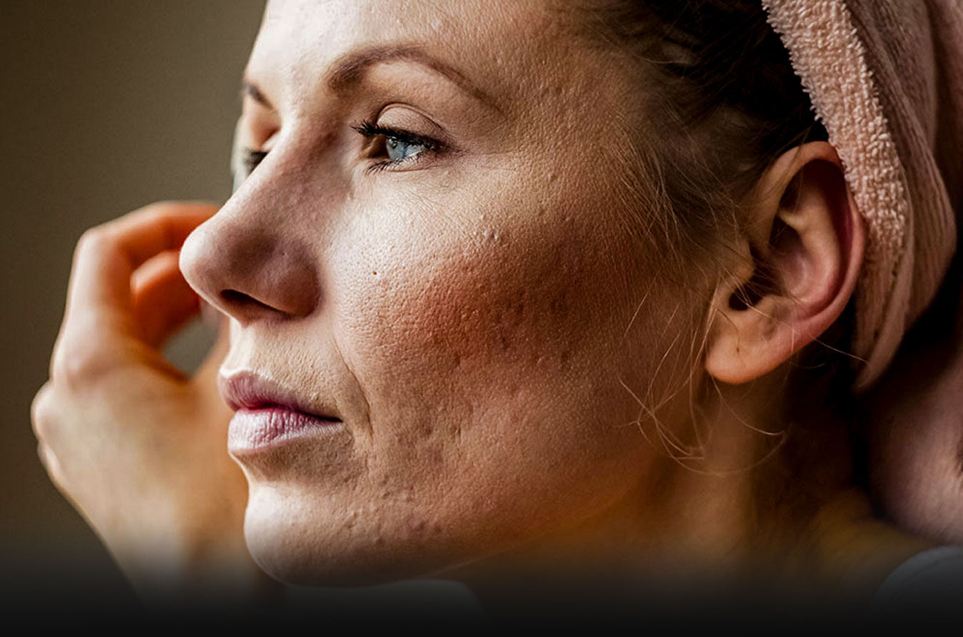 Fibromyalgia’s Link to Makeup: Understanding Skin Damage - Fibromyalgia ...